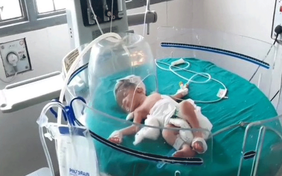 Dumped baby girl saved by stray dogs